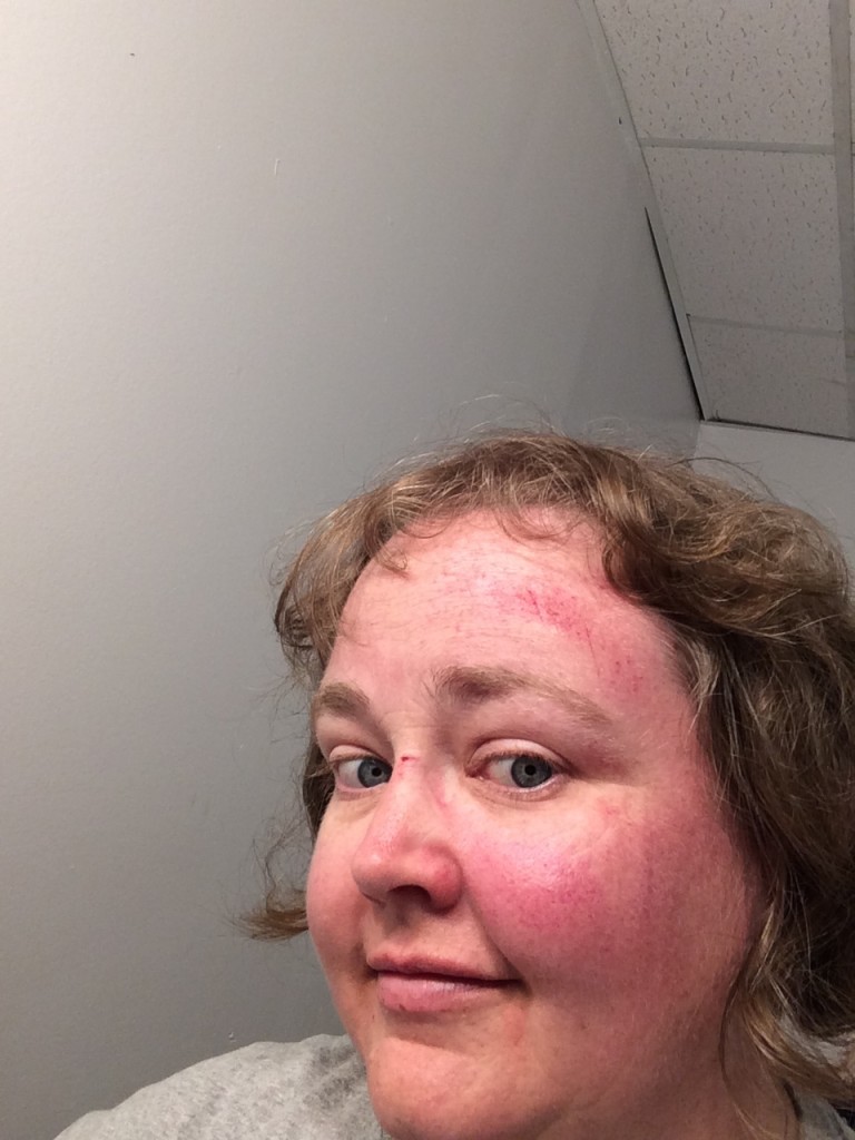 So I smashed my face… | LISA.BLOG